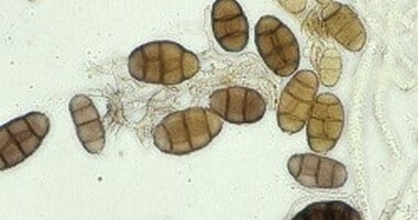 Types of Mold - Environix