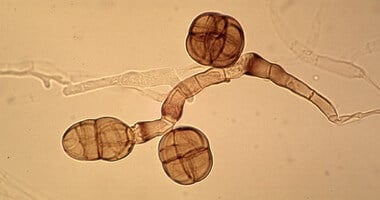 Types of Mold - Environix